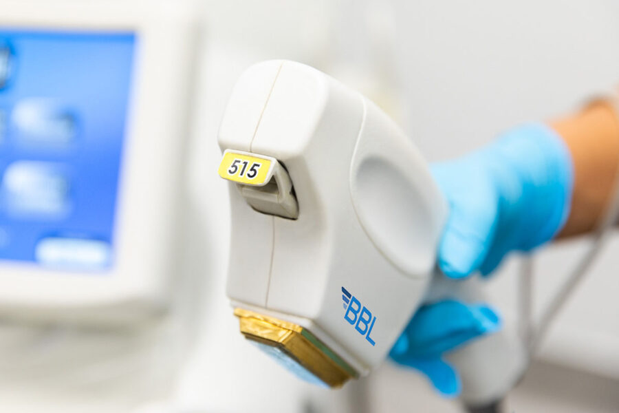 BroadBand Light (BBL) in Fort Wayne, IN | Femme Med and Spa