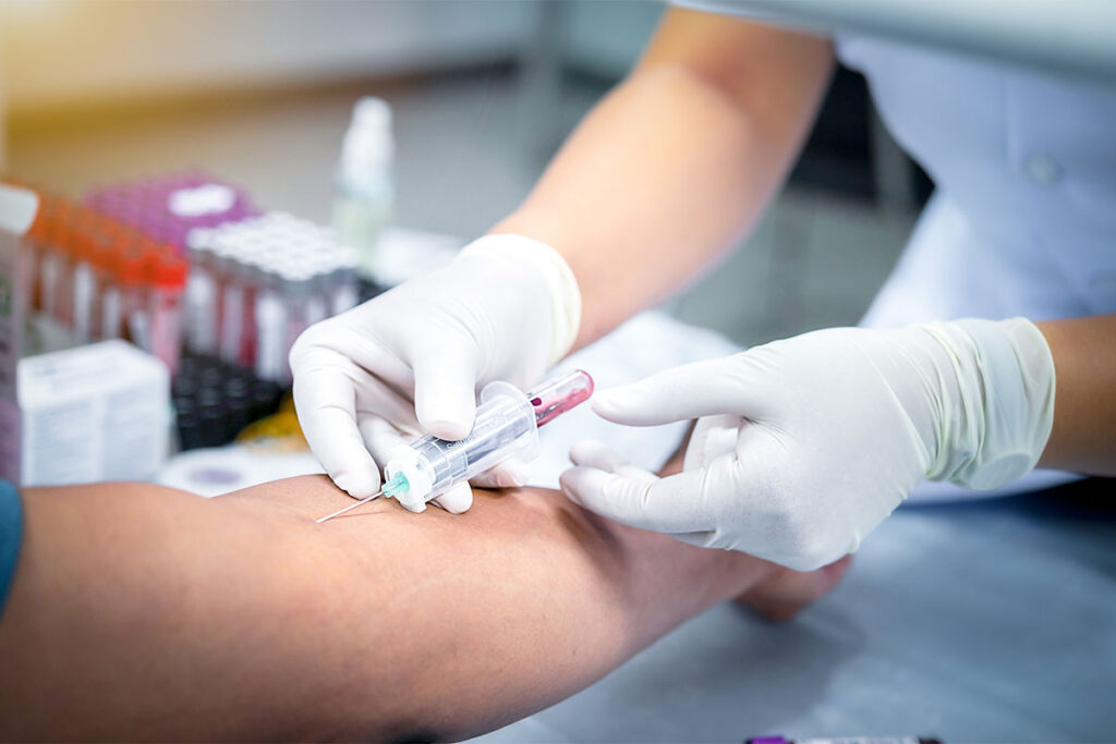 Blood Tests in Fort Wayne, IN | Femme Medical and Spa